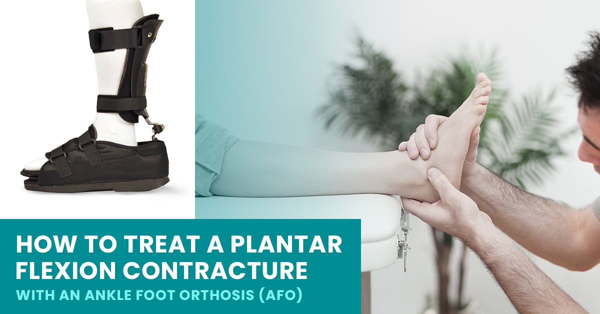 How to Treat a Plantar Flexion Contracture with an Ankle Foot Orthosis ...