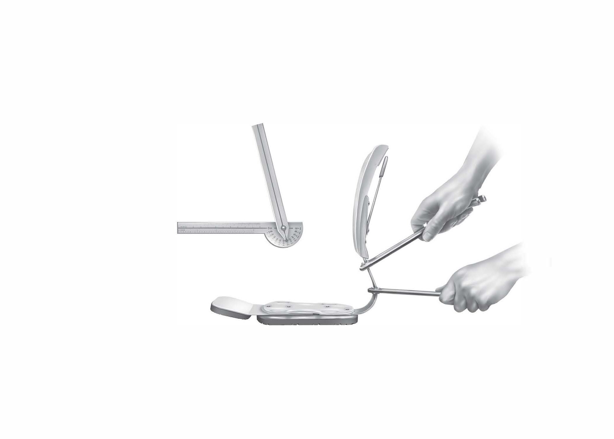 PRAFO® Ankle Foot Orthosis AFO | Anatomical Concepts, Inc.