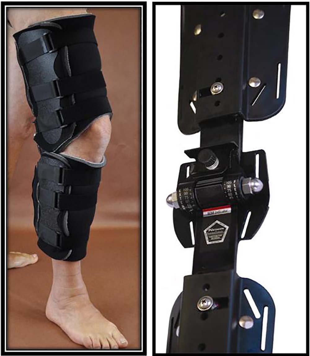 Pediatric PENTAGON® Knee Orthosis | Anatomical Concepts, Inc.