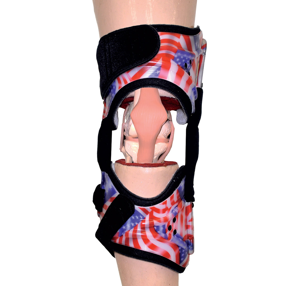 Custom V-VAS™ Knee Orthosis | Anatomical Concepts, Inc.